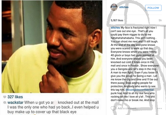 Stitches Reacts To Footage Of Himself Getting Jumped | Welcome To ...